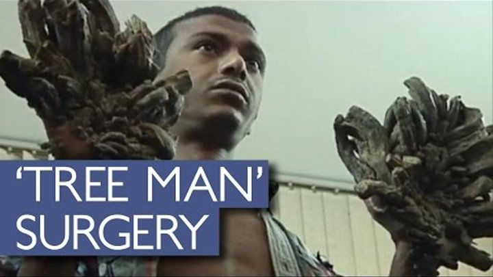 Bangladeshi 'Treeman' Begins Surgery For Bark-Like Warts